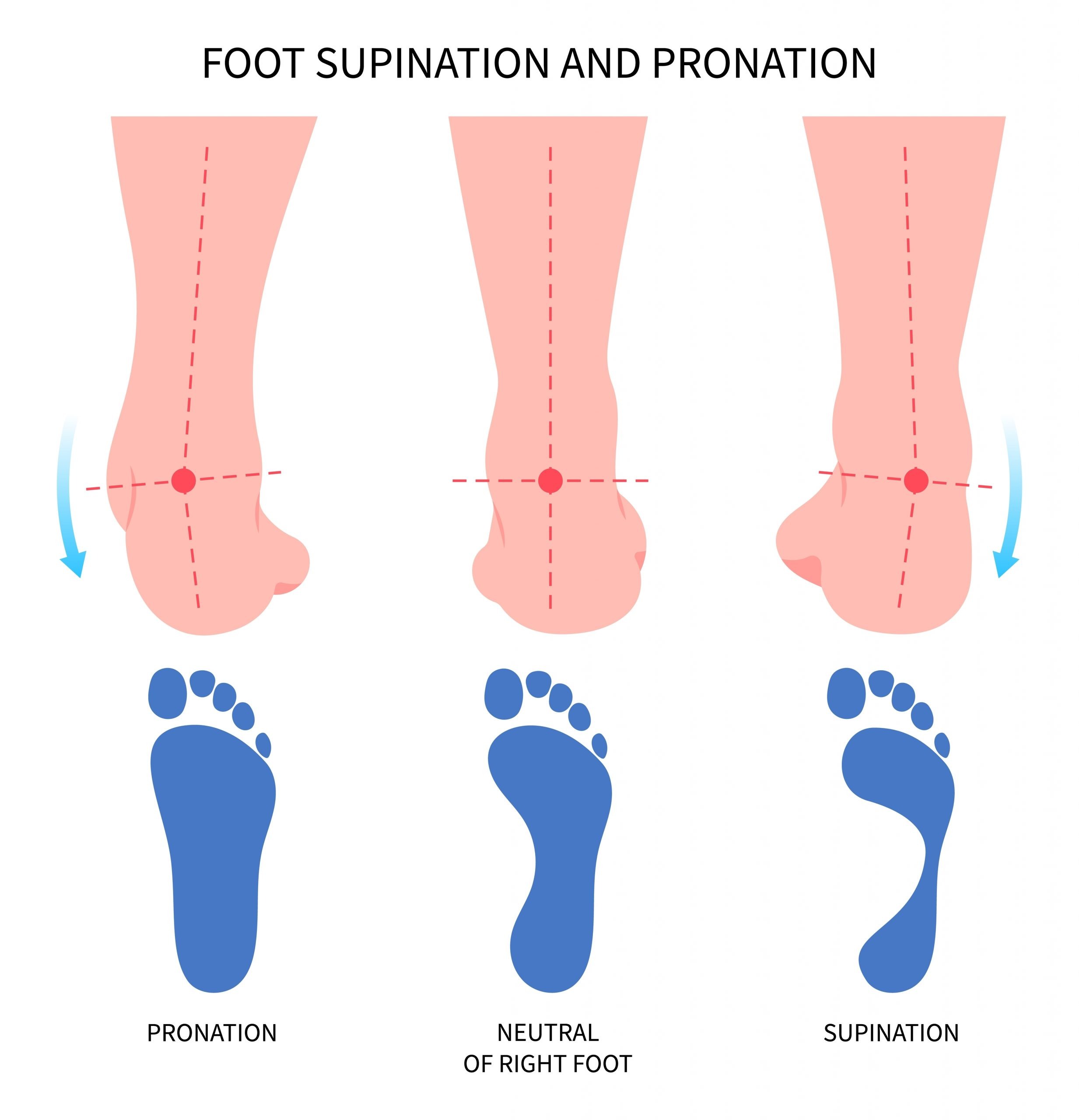 Athletic and Casual Shoes for Overpronation and Flat Feet